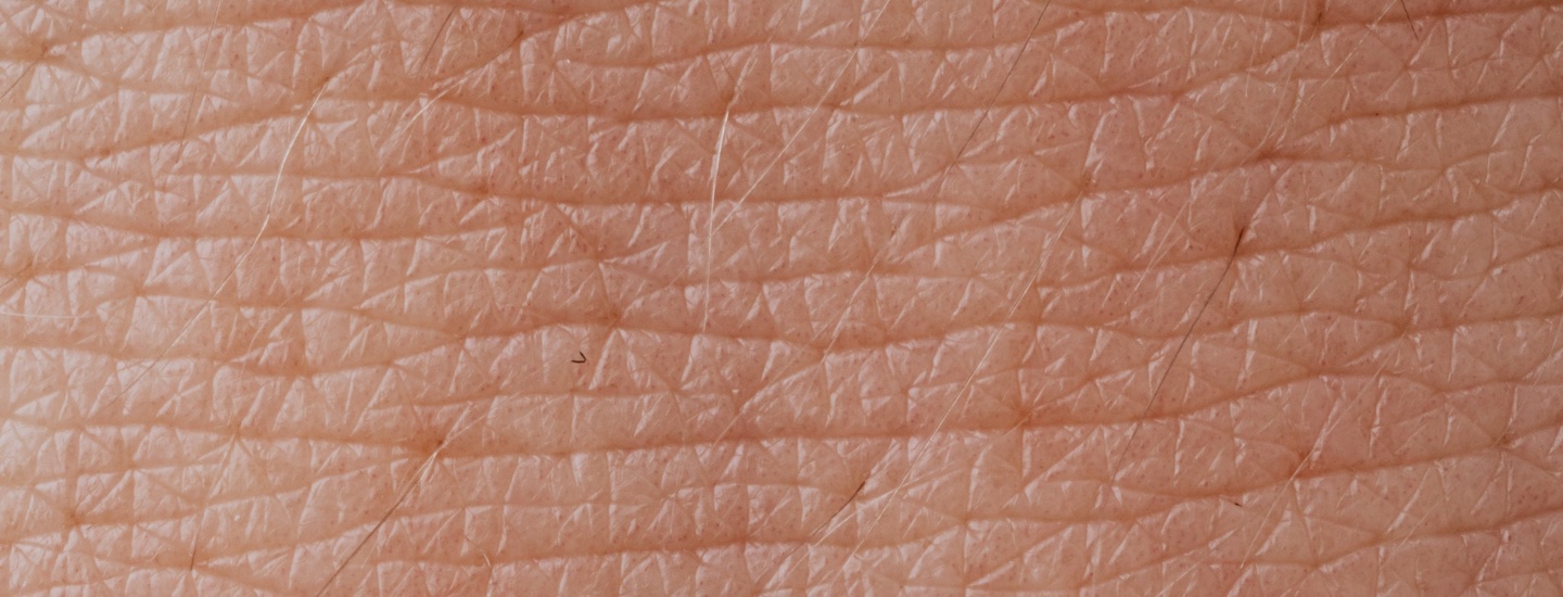 Dermolin, De Specialist In Hypoallergene Huidverzorging